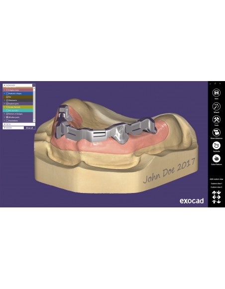EXOCAD DentalCAD 3D Design Software Bar Module