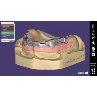 EXOCAD DentalCAD 3D Design Software Bar Module