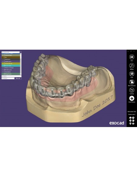 EXOCAD DentalCAD 3D Design Software Bar Module