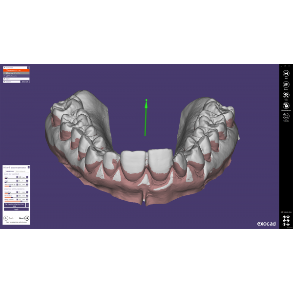 EXOCAD DentalCAD 3D Design Software Bite Splint Module