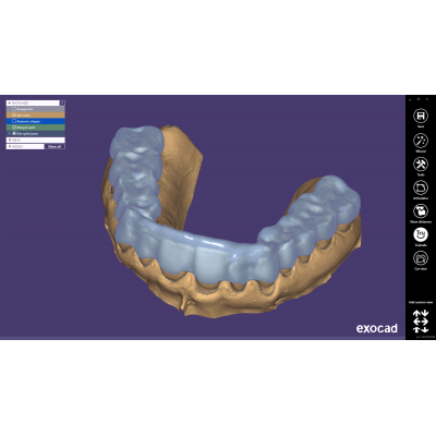 EXOCAD DentalCAD 3D Design Software Bite Splint Module
