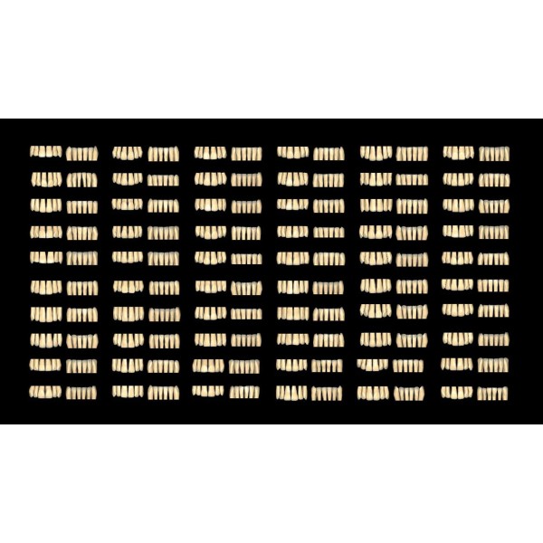 EXOCAD Tooth Library Module DentalCAD 3D Design Software