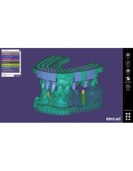 Model Creator Module of EXOCAD DentalCAD 3D Design Software