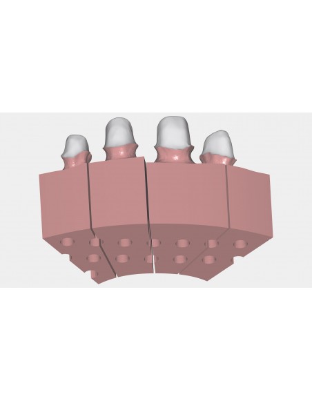 Model Creator Module of EXOCAD DentalCAD 3D Design Software