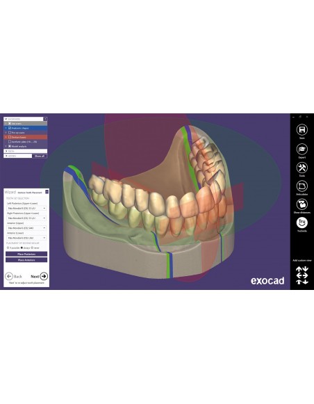 Full Denture Module of EXOCAD DentalCAD 3D Design Software