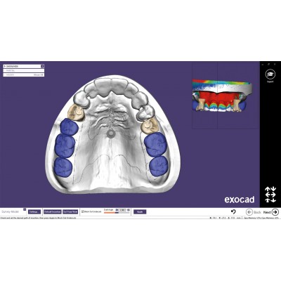 PartialCAD Module of EXOCAD DentalCAD 3D Design Software