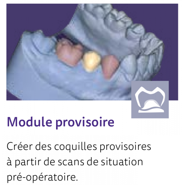 Provisional Module of EXOCAD DentalCAD 3D Design Software