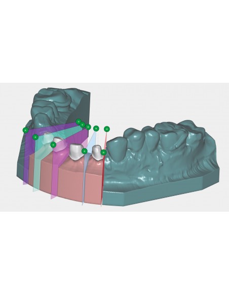 EXOCAD module Créateur de Modèles